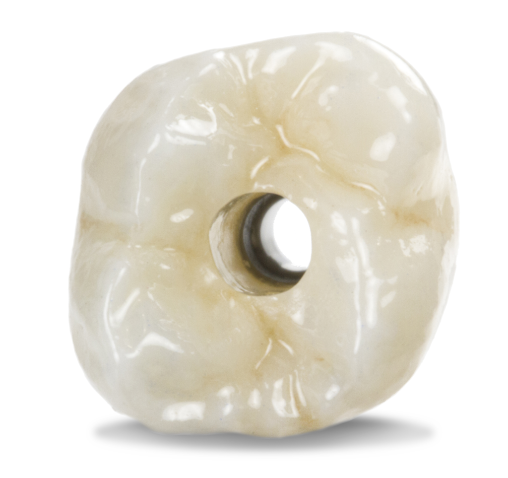 Implant | Ragle Dental Laboratory