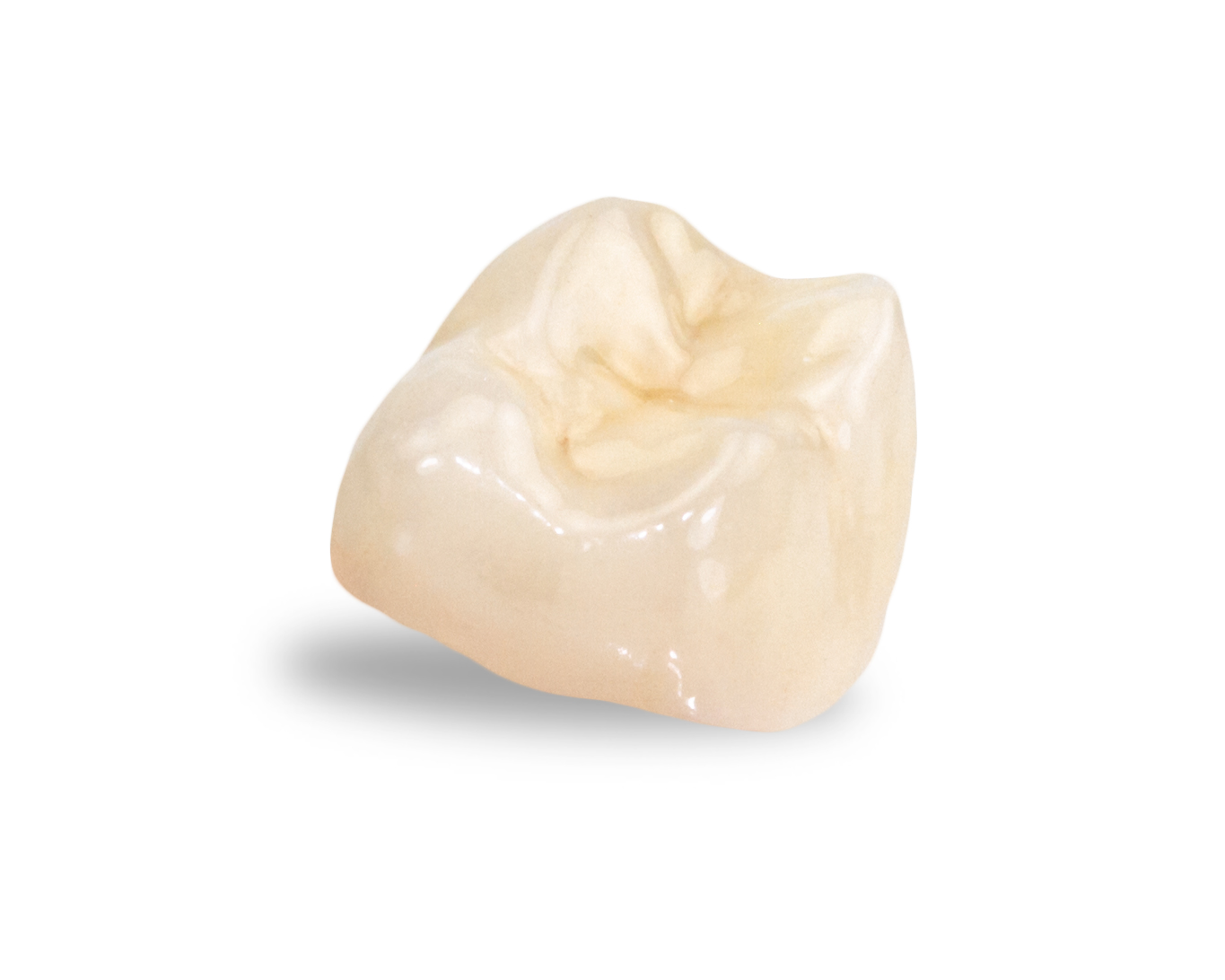 Rag Wheel Definition Dental at Randall Maupin blog